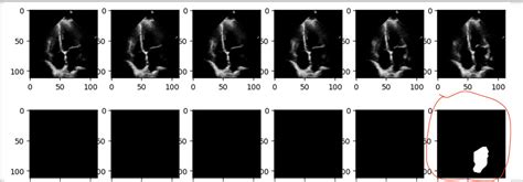 Get Dimensions Of Mask From Nii File Beginner Questions Itk