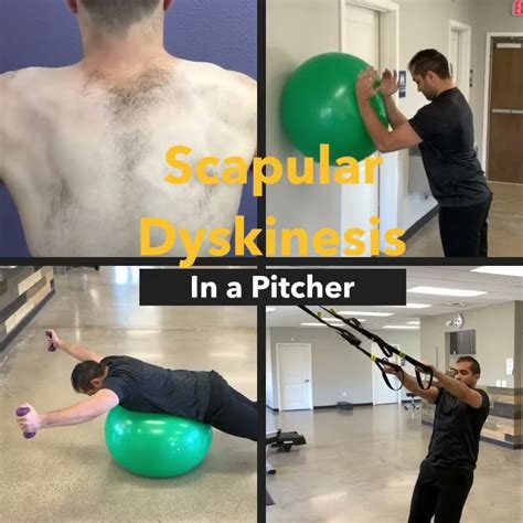 Scapular Dyskinesis Youtube