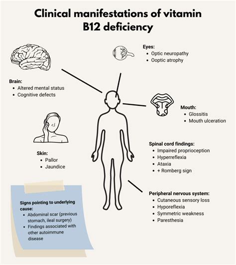 Vitamin B12 Deficiency Explained Jsefue