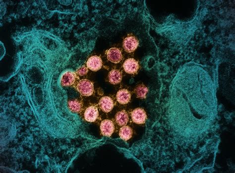 Cdc Tracking Ba2871 Sars Cov 2 Variant Cidrap