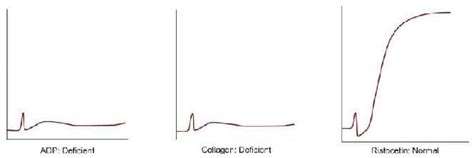 Platelet Aggregation Studies Platelet Aggregation Studies