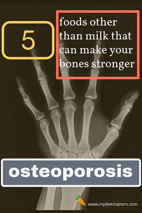 Meat Causes Bone Loss At Steven Broadnax Blog