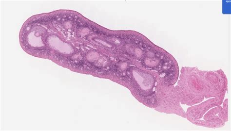 The Reproductive System Anatomy Human Anatomy And Physiology