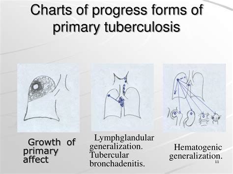 Ppt Pathological Anatomy Of Tuberculosis Powerpoint Presentation
