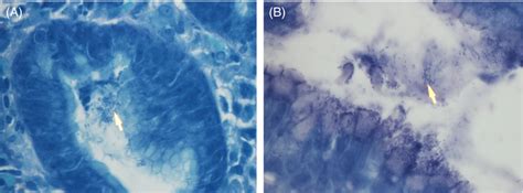 The Positive Results Of Helicobacter Pylori Infection By The Download Scientific Diagram