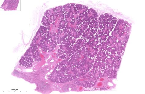 Histology Connective Tissue Flashcards Quizlet