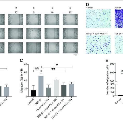 The inhibitory effect of WCJ 394 on the TGF β signaling pathway A