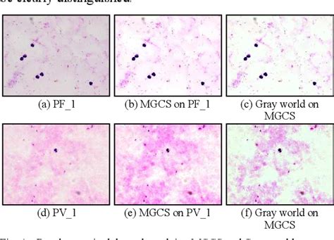 Figure From A Robust Segmentation Of Malaria Parasites Detection Using Fast K Means And