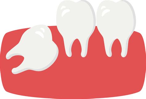 Impaction Teeth Illustration 51714374 Png