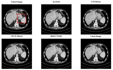 comparison of different deep learning methods for low dose ct images