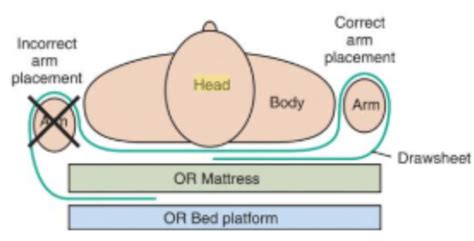 Positioning Supine Lithotomy Flashcards Quizlet