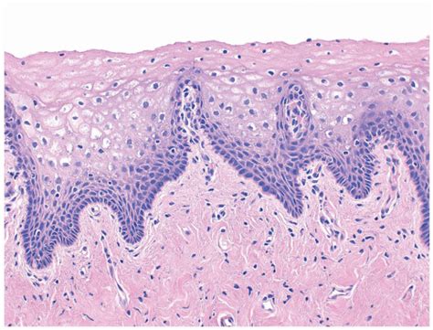 Vagina Basicmedical Key