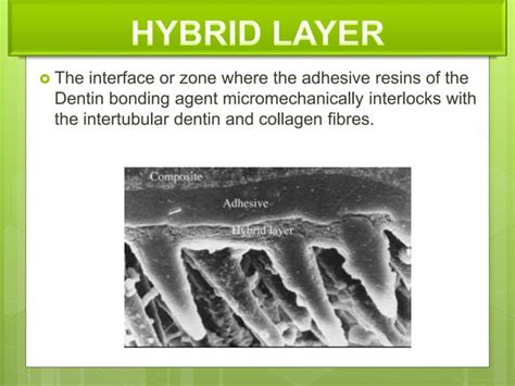 Dentin Bonding Agents Pptx