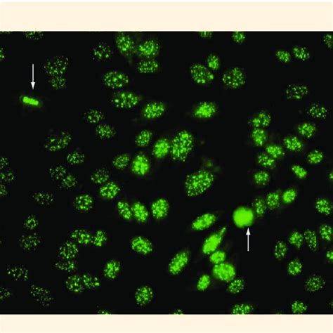 Rim Like Membranous Staining Pattern By Indirect Immunofluorescence On Download Scientific