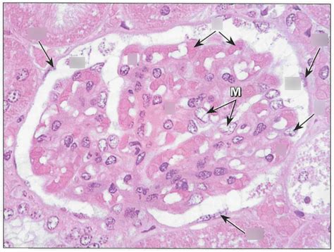 Urinary Histology 1 Diagram Quizlet