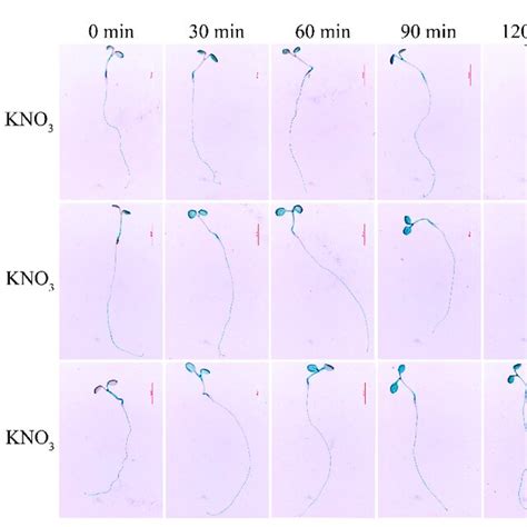 Gus Staining In Promdnrt11gus Transgenic Arabidopsis The