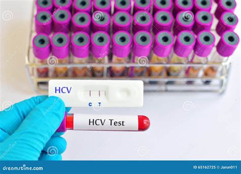 Hepatitis C Testing Stock Image Image Of Medicine Result 65162725