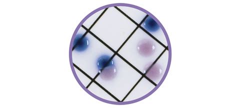 Chromagar Cca Chromagar