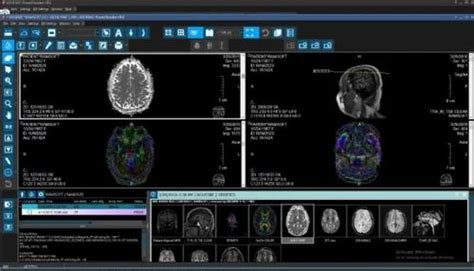 Dicom Viewer Pacs Software Free Demo Available At Best Price In Bengaluru