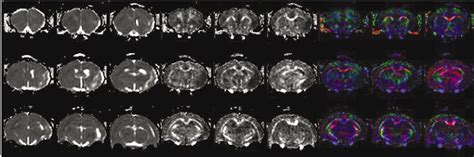 Representative Maps Of Adc Left 3 Â 3 Images Fa Middle 3 Â 3 Download Scientific Diagram