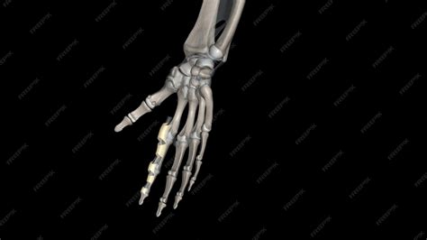 Premium Photo The Annular Ligament Is A Complex Structure Formed From The Capsule Lateral