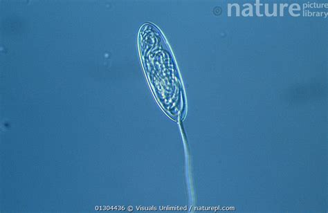 Nematocysts Under Microscope