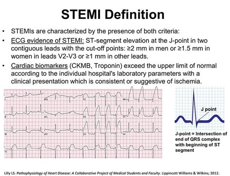 The Heart Definition Of Stemi Stemi Is A Clinical
