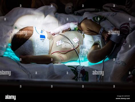 Avant Terme Banque De Photographies Et Dimages à Haute Résolution Alamy
