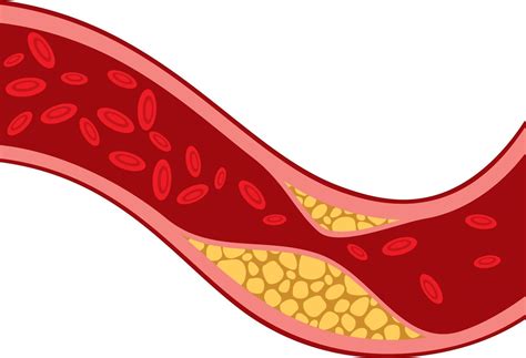 Cholesterol Vector Illustration 3192840 Vector Art At Vecteezy