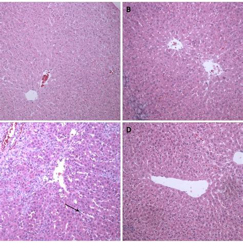 Photomicrograph Of Hepatic Tissue At 200 × Magnification In The Download Scientific Diagram