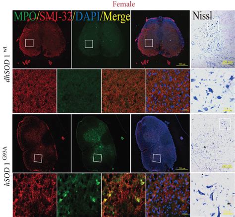 The Cellular Distribution Of Mpo Positive Signals And Nissl Staining In Download Scientific