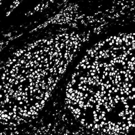 Revised Deep Learning Approach Using Matlab Caffe Python Andrew