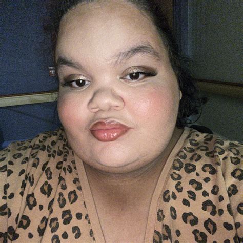 Acanthosis Nigricans Problems🙄 Rmakeupaddiction