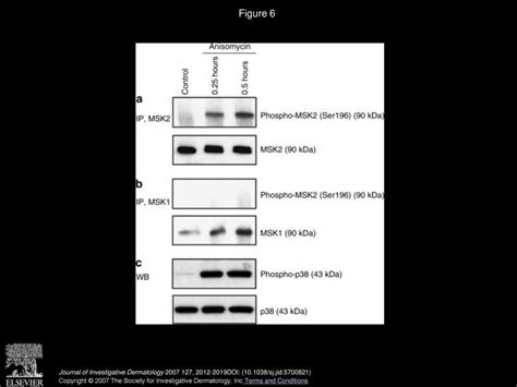 Mitogen- and Stress-Activated Protein Kinase 2 and Cyclic AMP Response ...