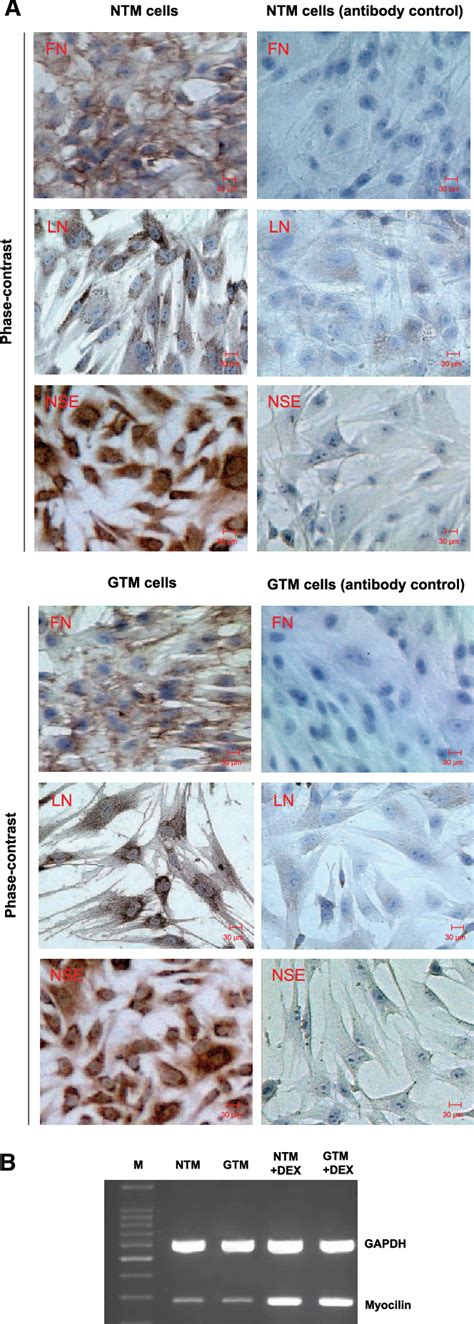 Itpr1 Gene Semantic Scholar