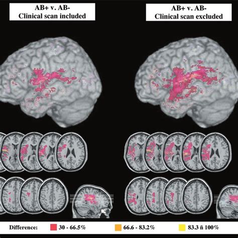 Within Groups Comparison Of Action Recognition Data Ideomotor Apraxia Download Scientific