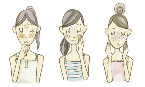 肌肤问题卡通皮肤卡通疑问卡通图片文秘苑图库