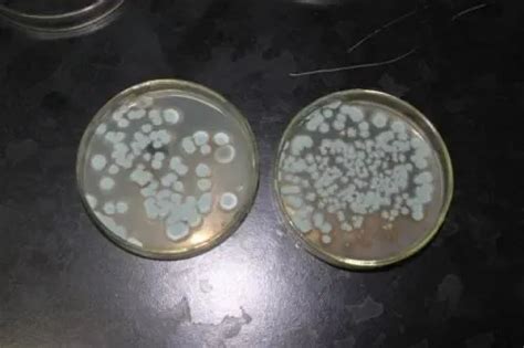 检测固体培养基灭菌效果的常用方法