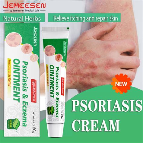 Jemeesen Psoriasis Cream Gamot Sa Kati Kati Sa Balat Ointment For Skin
