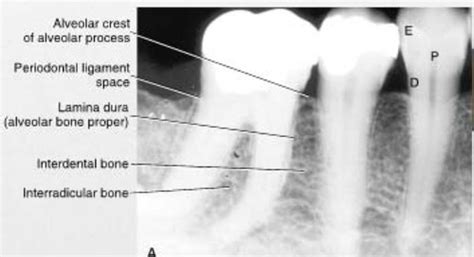 Ch 142 Alveolar Process Flashcards Quizlet
