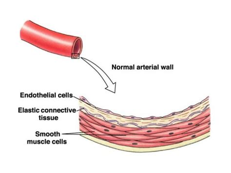 Endothelial Dysfunction In Indian Scenario