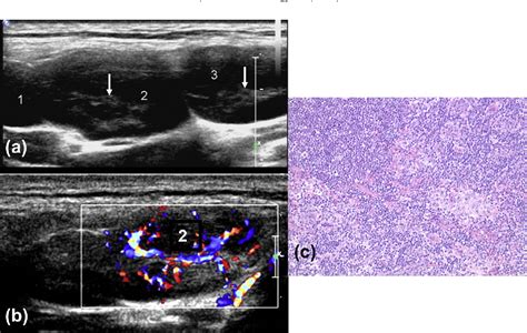 Structure Of Hilum Of Lymph Node Semantic Scholar
