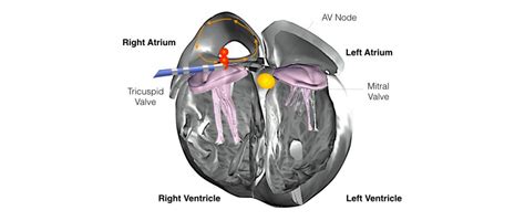 Atrial Flutter Ablation One Heart Cardiology Atrial Flutter Ablation One Heart Cardiology