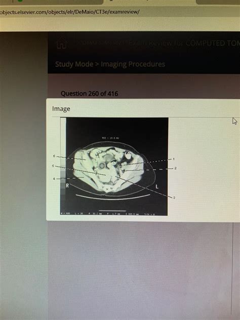 Ct Axial Pelvis Diagram Quizlet