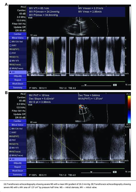 Transthoracic Echocardiography Download Scientific Diagram