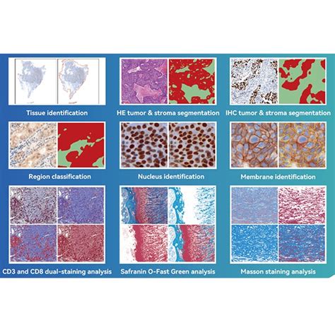 winquant quantification software randd manufacturer china
