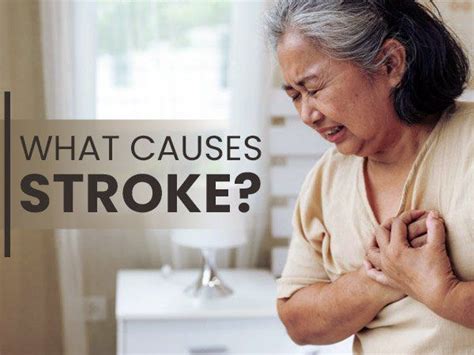 What Is A Stroke Symptoms Causes Diagnosis Treatment And Prevention