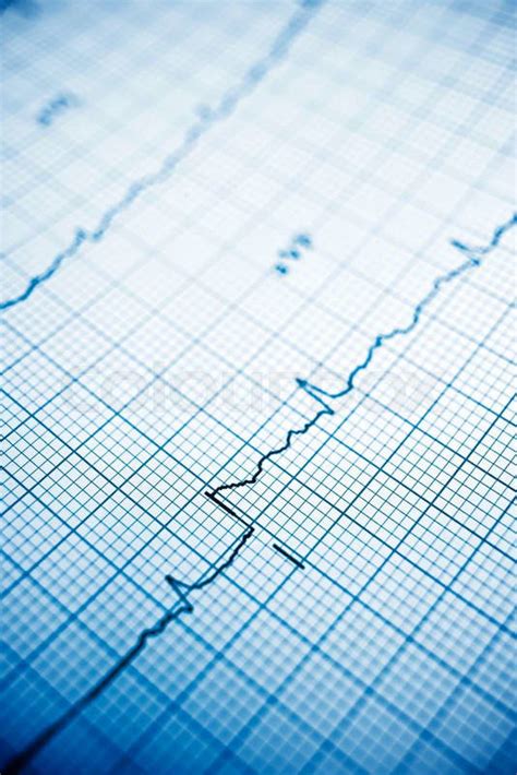 Close Up Of An Electrocardiogram In Paper Form Colourbox