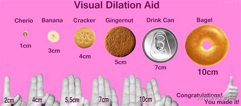 Labour And Delivery Dilation Visual By Anton Jones Redbubble