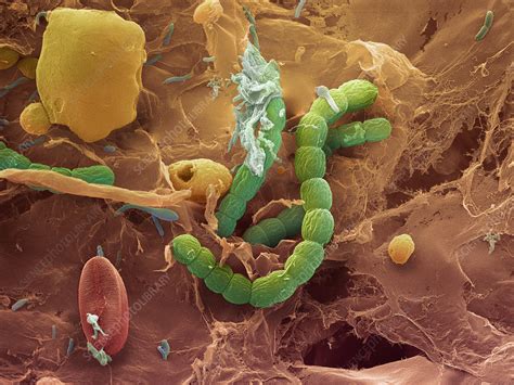 Bacteria Sem Stock Image C0304891 Science Photo Library